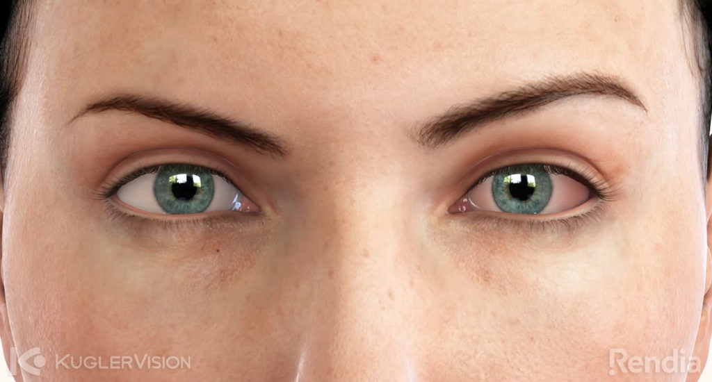 5 Common Eye Conditions - Kugler Vision