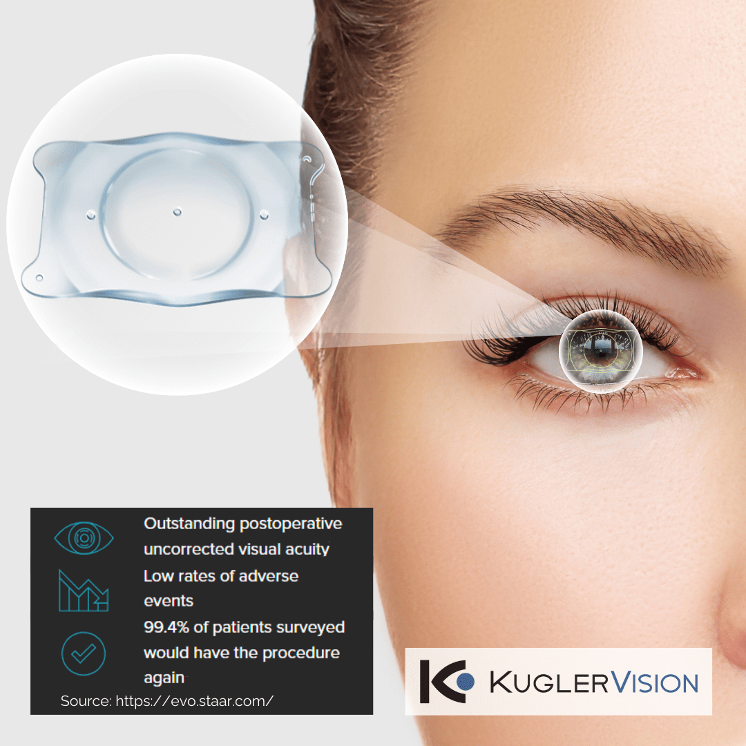 Get To Know The EVO ICL Procedure